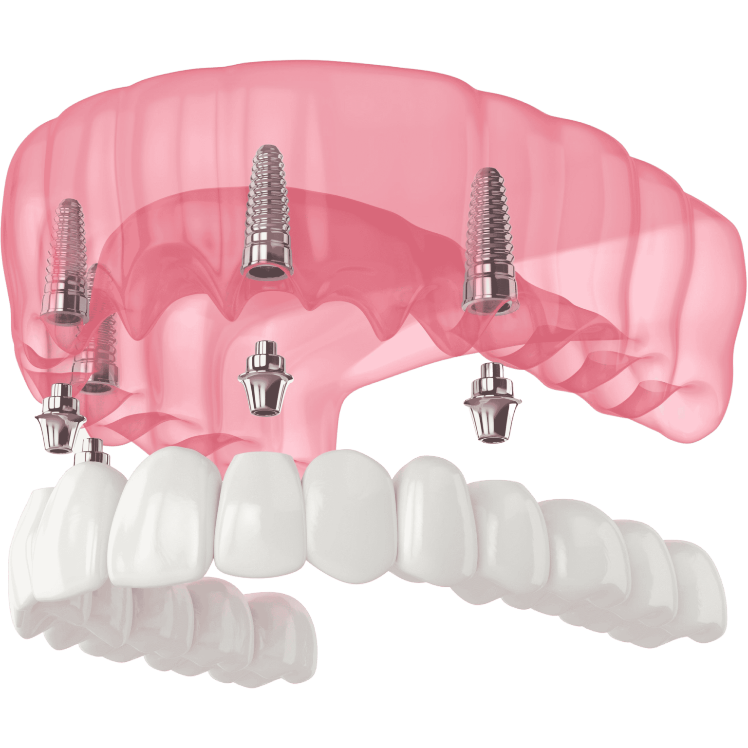 Optum Dental Arts – Tampa, FL